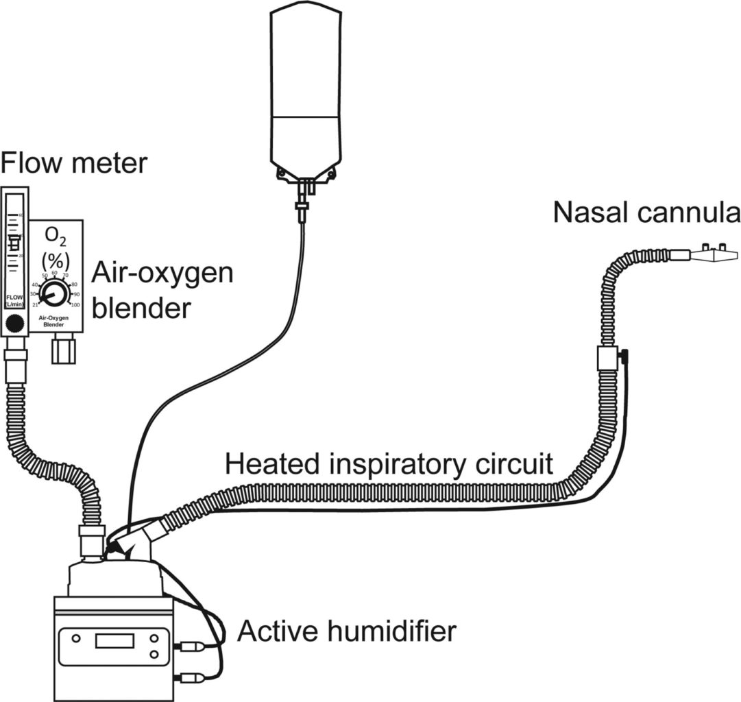 Etude sur l'impact de la température et du débit de l'optiflow sur le ...